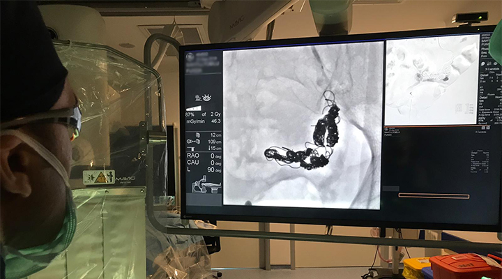 İntravenöz Pyelografi ( İVP )