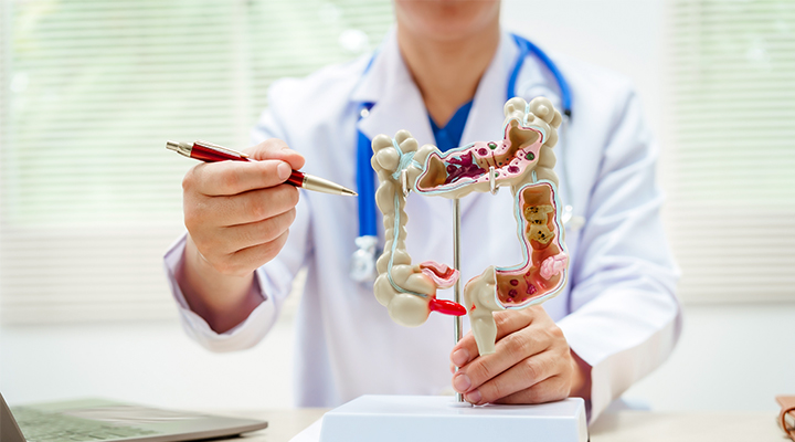 Who Gets Colon Cancer?